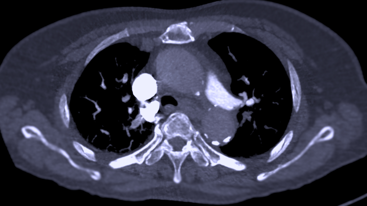 Aidoc Always On Healthcare AI