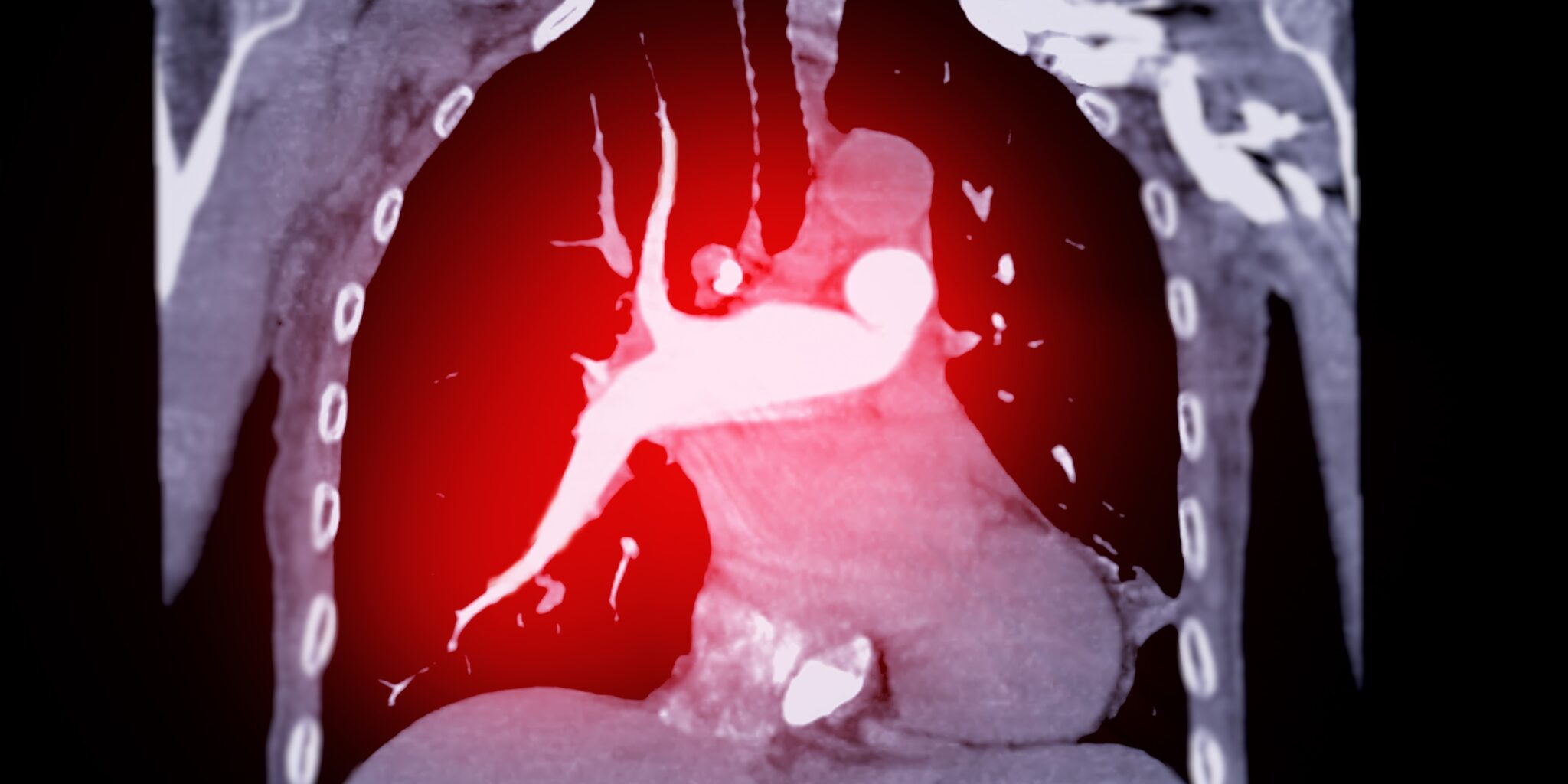 Read Our Latest News and Updates | Aidoc